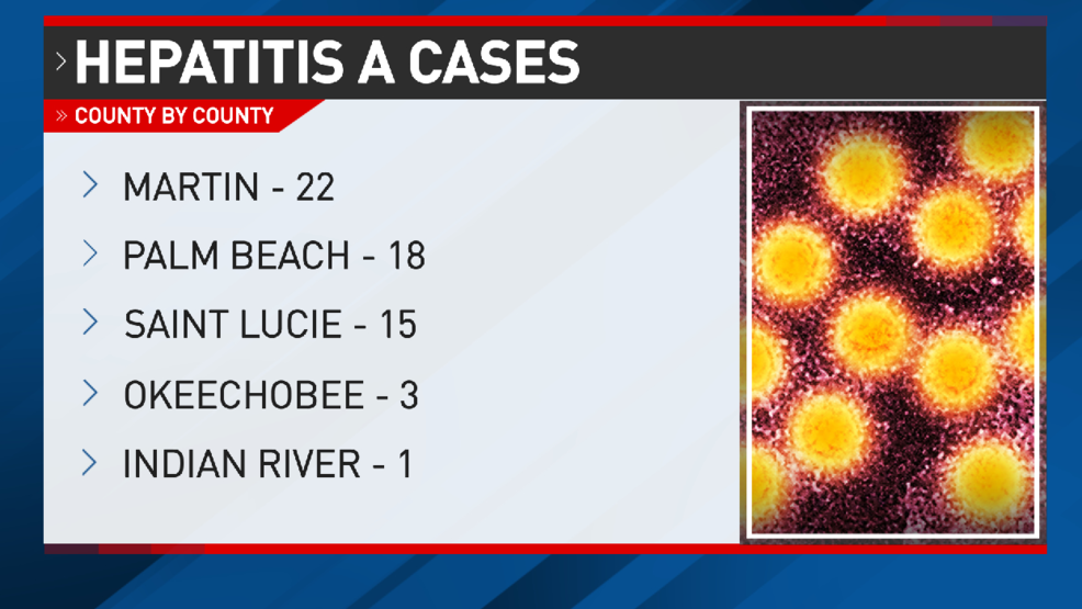 First case of Hepatitis A reported in Indian River County | WPEC